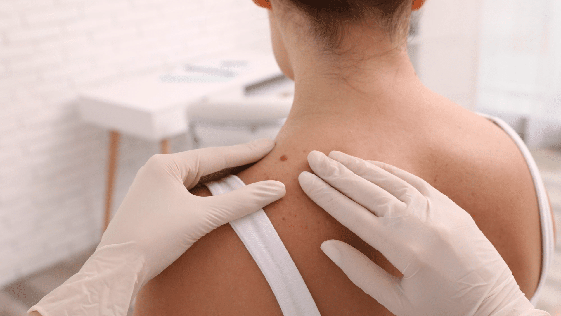 My Step-By-Step Guide to Laser Skin Tag Removal - Beauty And Blog
